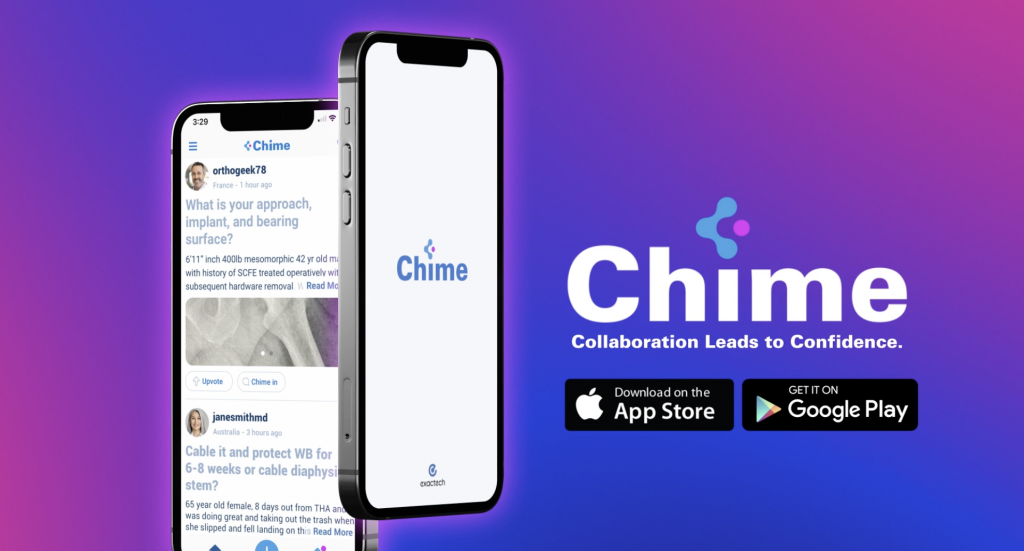 Chime Archives | staging.exac.com