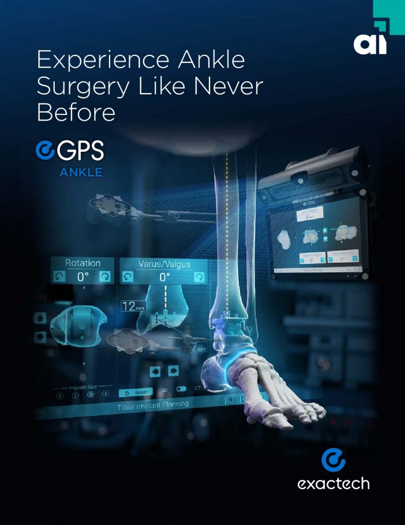 GPS Ankle Product Sheet – staging.exac.com